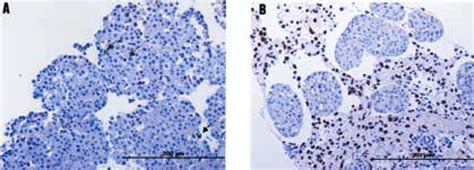 Macrophage Detection In Isolated Islets And Islet Grafts Sections Were