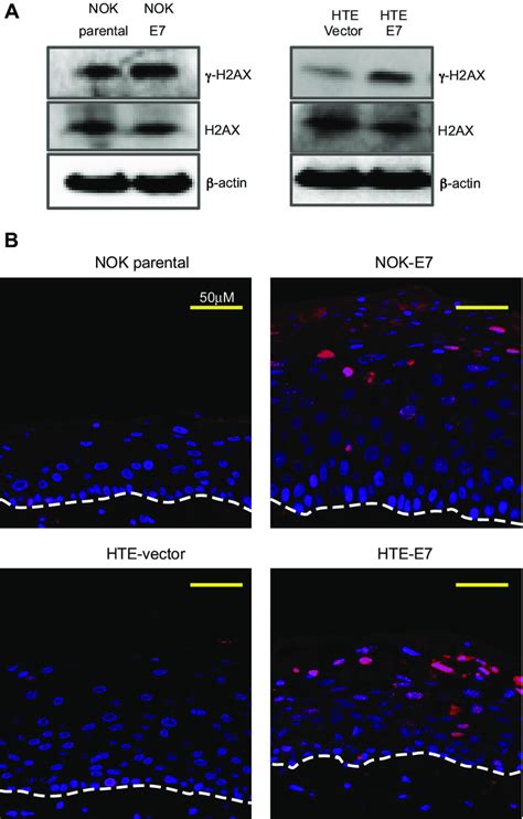 Hpv16 E7 Expression Led To An Induced C H2ax Expression And An