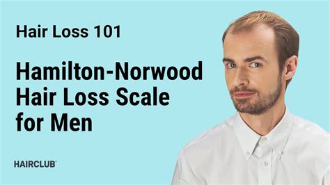 Hamilton Norwood Hair Loss Scale For Men Male Pattern Baldness Youtube