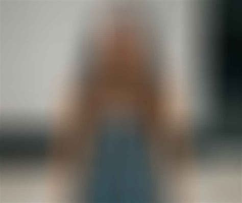 Understanding Toxic Conjunctivitis Causes Symptoms And Care Specialty Vision