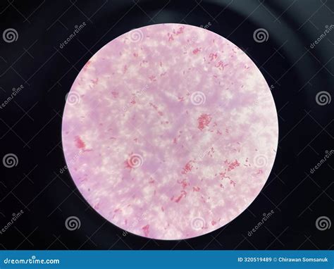 Moderate Gram Nagative Bacilli With White Blood Cells Royalty Free