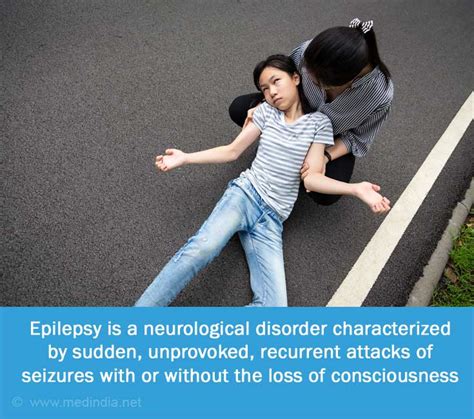 Wearable Devices The Futuristic Slant In Epilepsy
