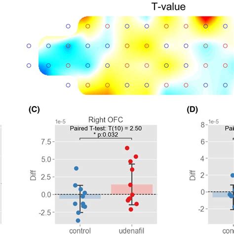 Comparison Of Fnirs Data In The Korean Color Word Stroop Test K Cwst
