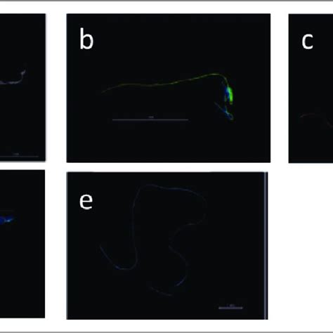 Examples Of Primary And Secondary Microplastics And Cause Of Their