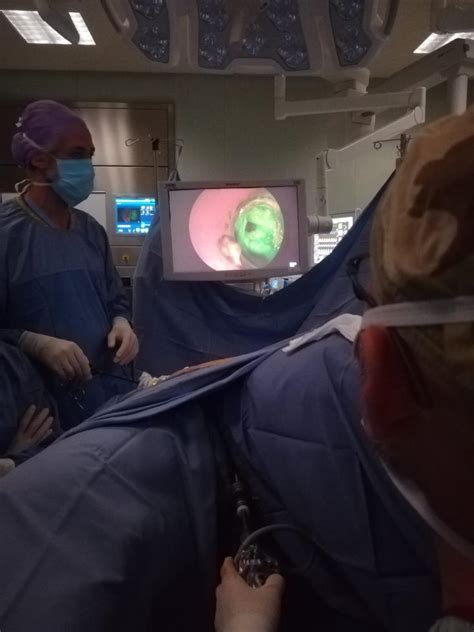 Andrea Lucchi Md Facs On Linkedin Endoscopic Green Indocyanin