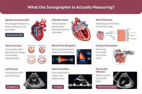 How Accurate Is An Echocardiogram To Detect A Heart Condition
