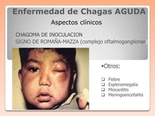 Enfermidad De Chagas Ppt
