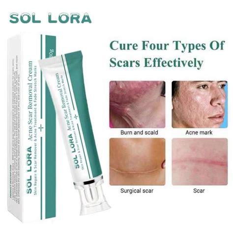 ครีมซ่อมแซมผิว Sol Lora สำหรับลดรอยแผลเป็น Gaawo Th