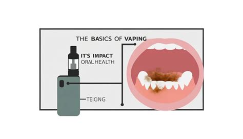 Vaping Teeth Staining Nicotine Oral Health Complete Guide