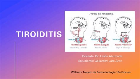 Tiroiditis Tiroiditis Autoinmunitaria Tiroiditis Subaguda Indolora Tiroiditis Subaguda