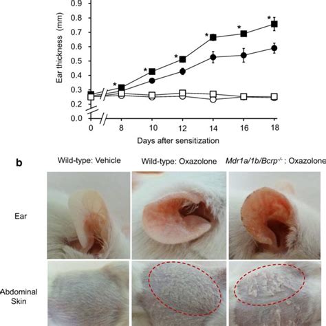 Difference In Oxazolone Induced Dermatitis Between Wild Type Download Scientific Diagram