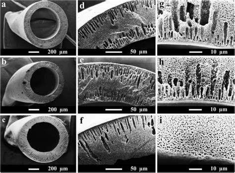 Phase Inversion Polymer Electrolytes For Energy Storage Devices