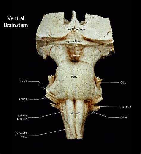 Brain Stem Ventral Anatomy