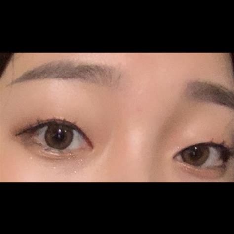 절개 눈매교정 눈 시술・수술후기 By 듀케인 바비톡