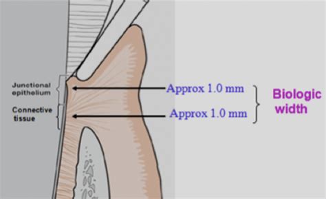 Chapter 10 Gingival And Dentogingival Junctional Tissue Flashcards Quizlet