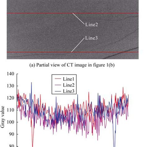 Gray Value Distribution Of Ct Image Download Scientific Diagram