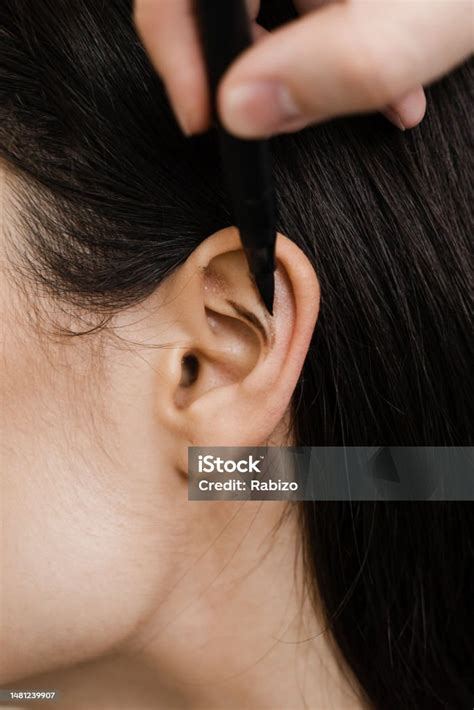 귀 수술 전 귀 성형술 클로즈업 외과의는 귀 성형술 전에 귀에 표시를 그립니다 귓바퀴와 귀의 외과적 재형성을 위한 귀 성형술