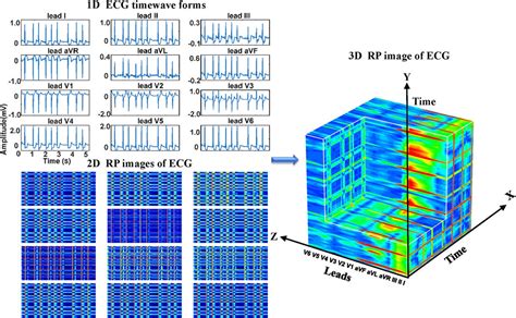 Frontiers Cardiac Arrhythmia Classification Based On 3d Recurrence Plot Analysis And Deep Learning