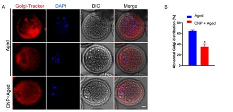 Figures And Data In C Type Natriuretic Peptide Improves Maternally Aged Oocytes Quality By