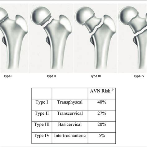Delbet Classification Of Femoral Neck Fractures Download Scientific Diagram