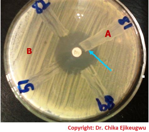 Understanding Mbl Microbiology Metallo β Lactamase Mbl Detection Methods Microbiology Class