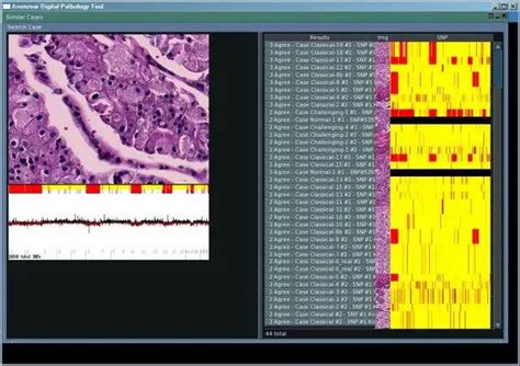 Avenzoar Digital Pathology Tool Download For Windows