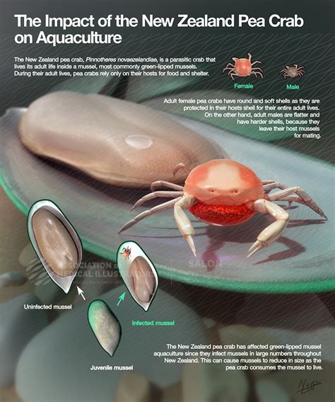Phacoemulsification With Intraocular Lens Implantation Ami 2018 Meeting