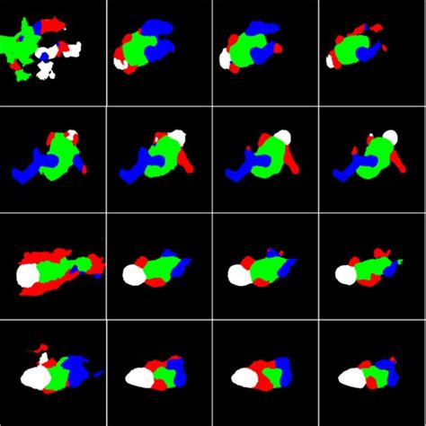 comparison between different body parsing methods on bht dataset 1st