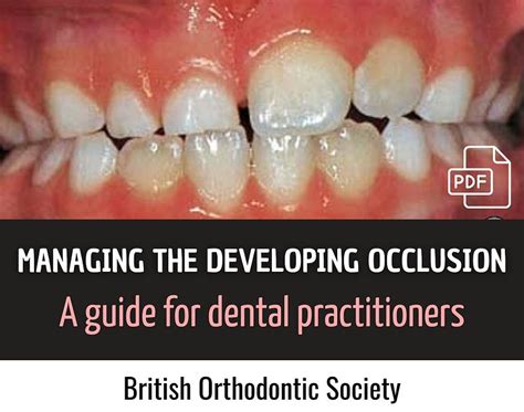 Pdf Managing The Developing Occlusion A Guide For Dental Practitioners