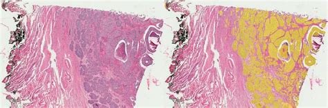 Histological Image Segmentation Applications Nikon Bioimaging Lab