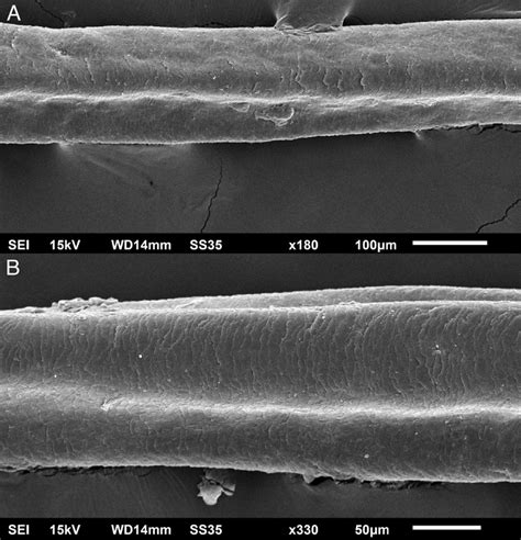 Scanning Electron Microscopy Eyelash Examination Small A And Medium