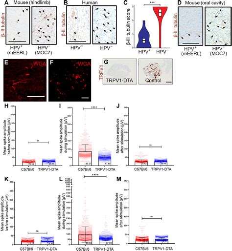 Functional Neuronal Circuits Promote Disease Progression In Cancer
