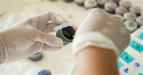 Stool Tests For Ibd Ibdrelief