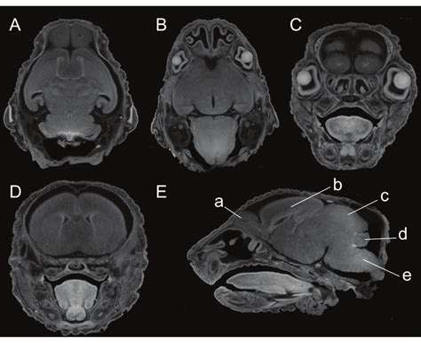 Micro Ct Imaging And Morphometric Analysis Of Mouse Neonatal Brains