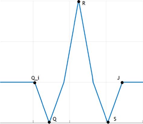 Characteristic Points Of The QRS Complex Download Scientific Diagram