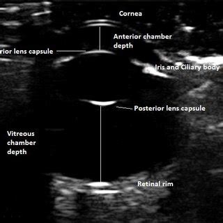 Ultrasonographic Appearance Of Goat Eye Download Scientific Diagram