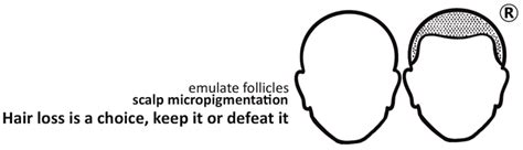 Scalp Micropigmentation
