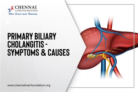 Does Pbc Only Affect Women Chennai Liver Foundation