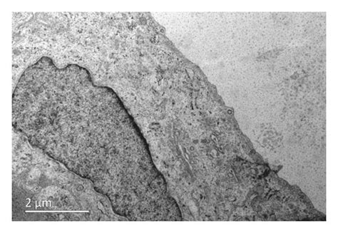 Transmission Electron Microscopy Of The Corneal Endothelium And Retina Download Scientific