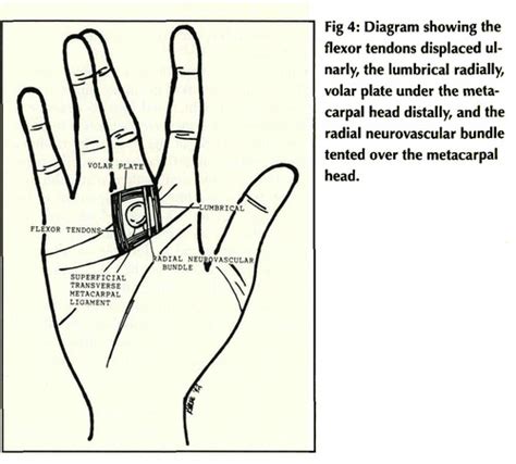 Metacarpophalangeal Joint Flexion