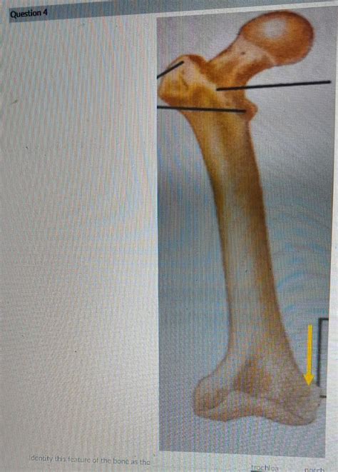 Solved Kindly Identify The Feature Of The Bone With The