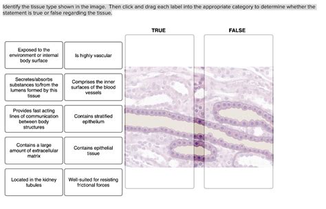 Solved Identify The Tissue Type Shown In The Image Then