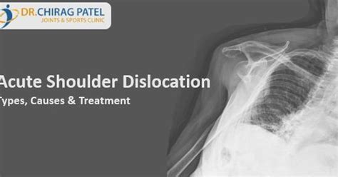 Dr Chirag Patel Common Causes Of Shoulder Dislocation Shoulder