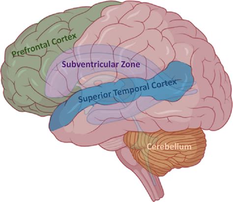 The Spectrum Of Pre‐mrna Splicing In Autism Engal 2024 Wires Rna Wiley Online Library