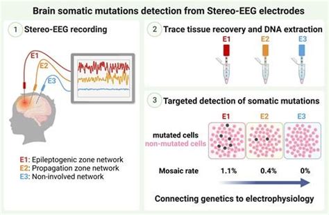 Alain Toulmond On Linkedin Detection Of Brain Somatic Mutations In Focal Cortical Dysplasia During