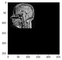 Affine Transforms Using Scikit Image Bio Image Analysis Notebooks