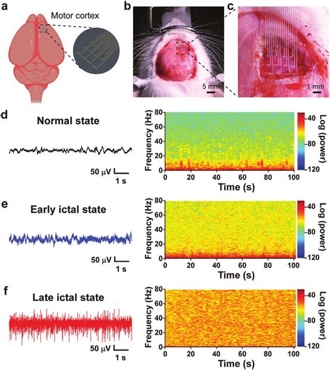 In Vivo Signal Recording With Liquid Metal Neural Electrode Arrays A