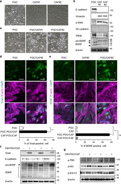 Promotion Of Emt And Upregulation Of Bdnf In Pgc Cells By Co Culture