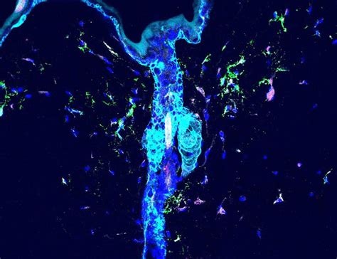 Convergent Evolution Of Monocyte Differentiation In Adult Skin Instructs Langerhans Cell