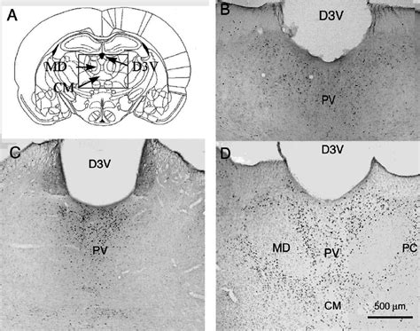 Fos Immunopositive Neurons In The Midline And Intralaminar Thalamic Download Scientific Diagram
